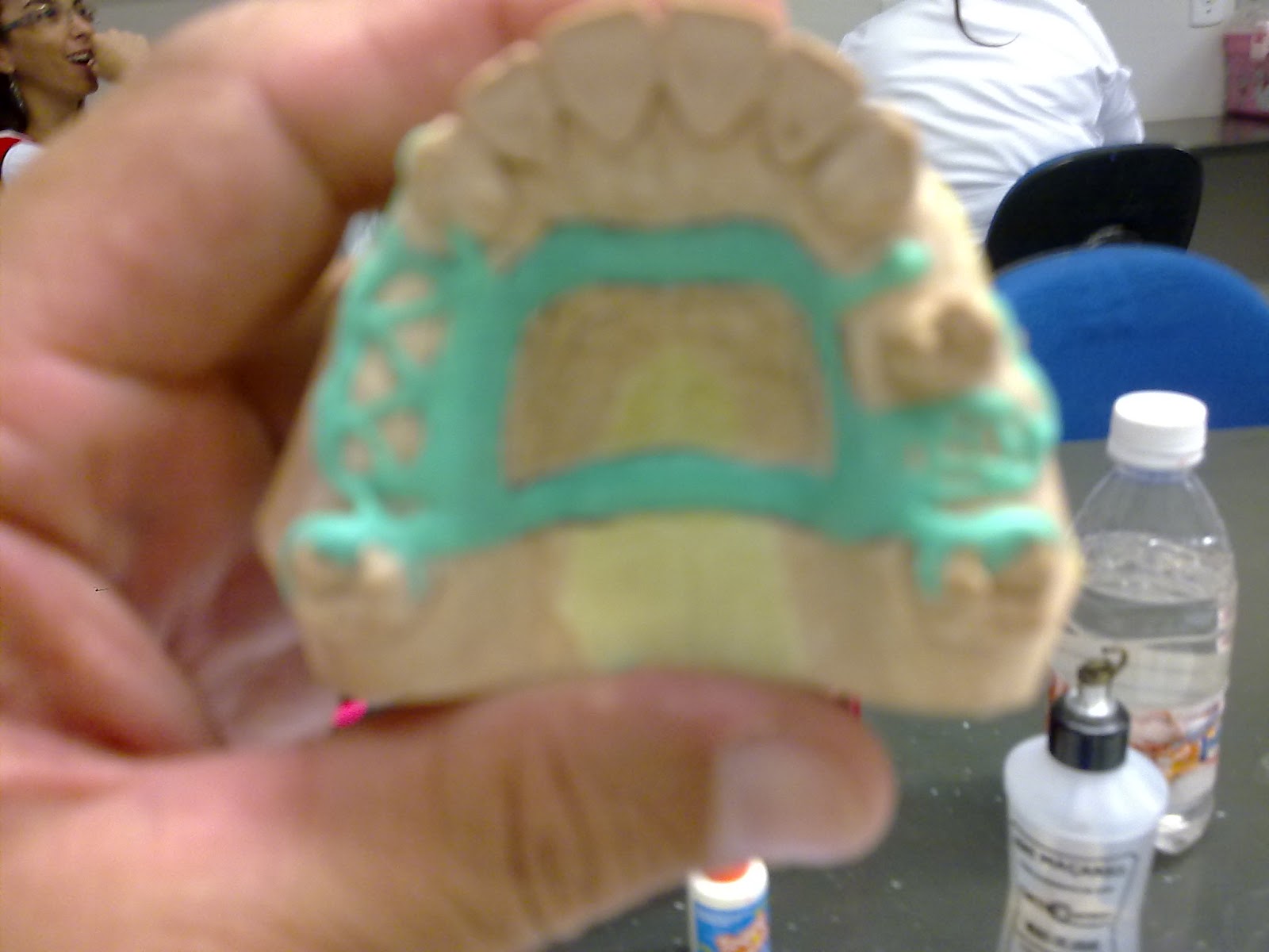 Protese Dentária: PPR - Algumas dicas para Avaliação Final - Profº ...