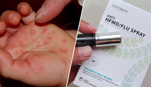 'Produk Anti HFMD/Flu Spray buat tuntutan tak berasas' - KKM | The Reporter