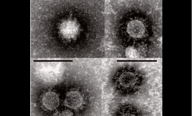 Confirman primer caso del virus chikungunya en México - Toluca Noticias ...