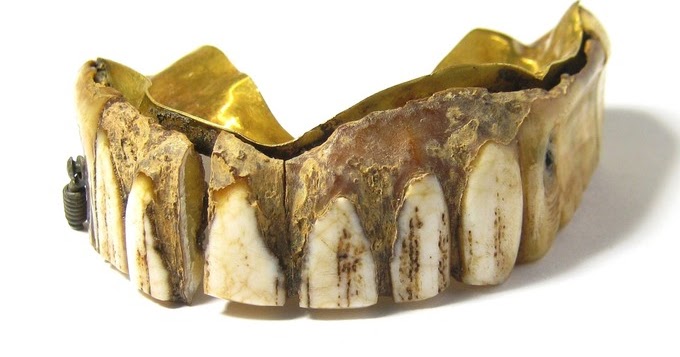 Ancient Artifacts: 200-year-old set of false teeth go under the hammer