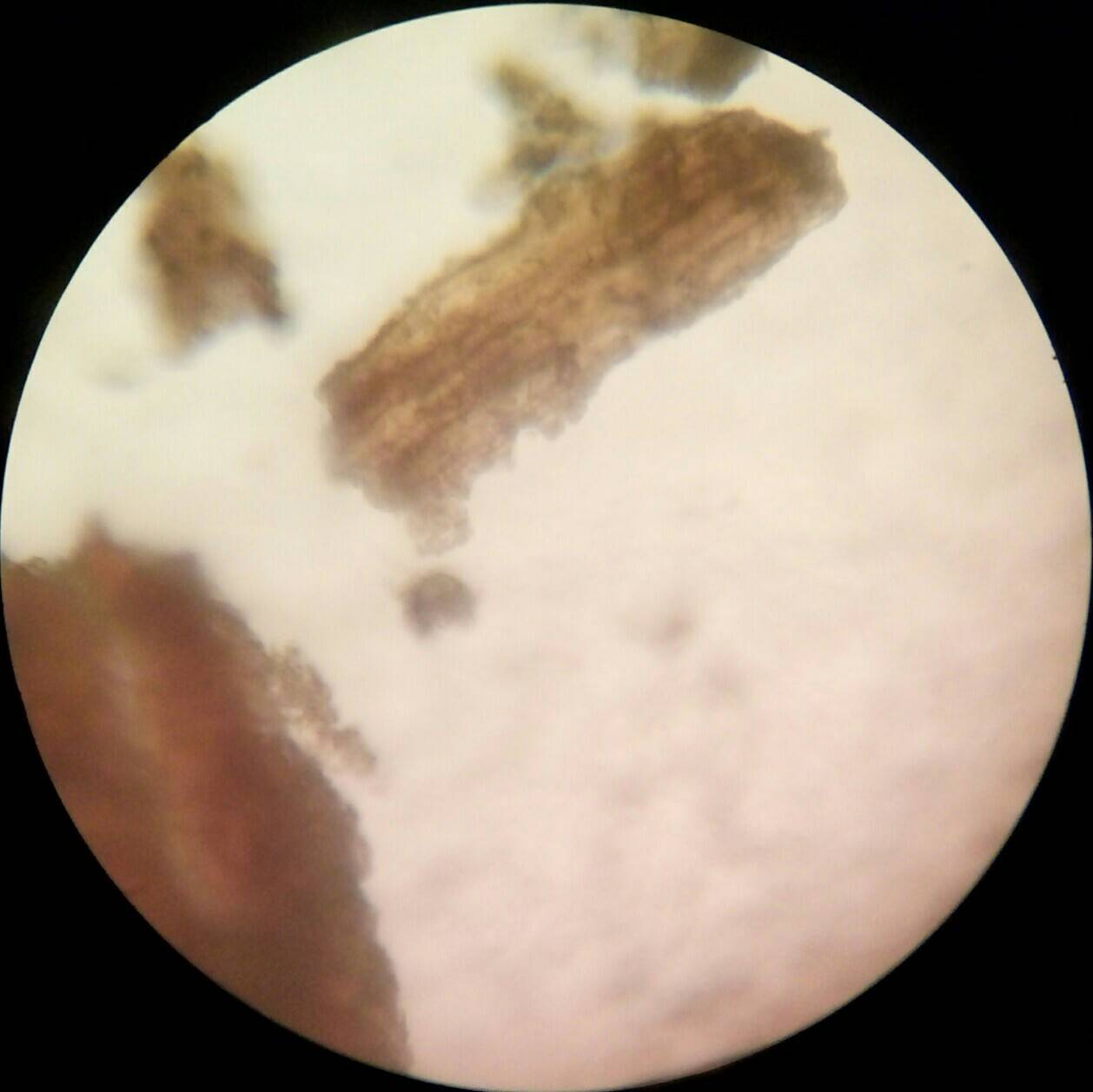 PIPERIS NIGRI FRUCTUS | F.NOSI MIKROSKOPIS