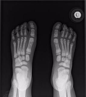 Casos de radiología de la Clínica Universidad de Navarra: septiembre 2016