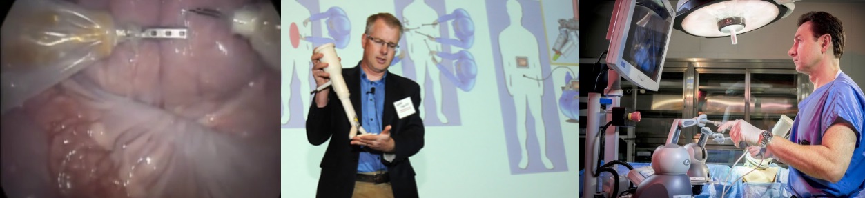 First human operation with Virtual Incision's system