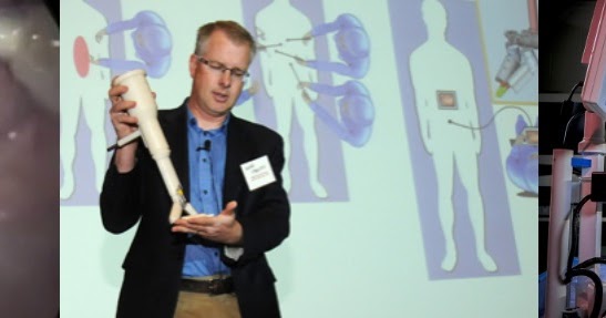 First human operation with Virtual Incision's system