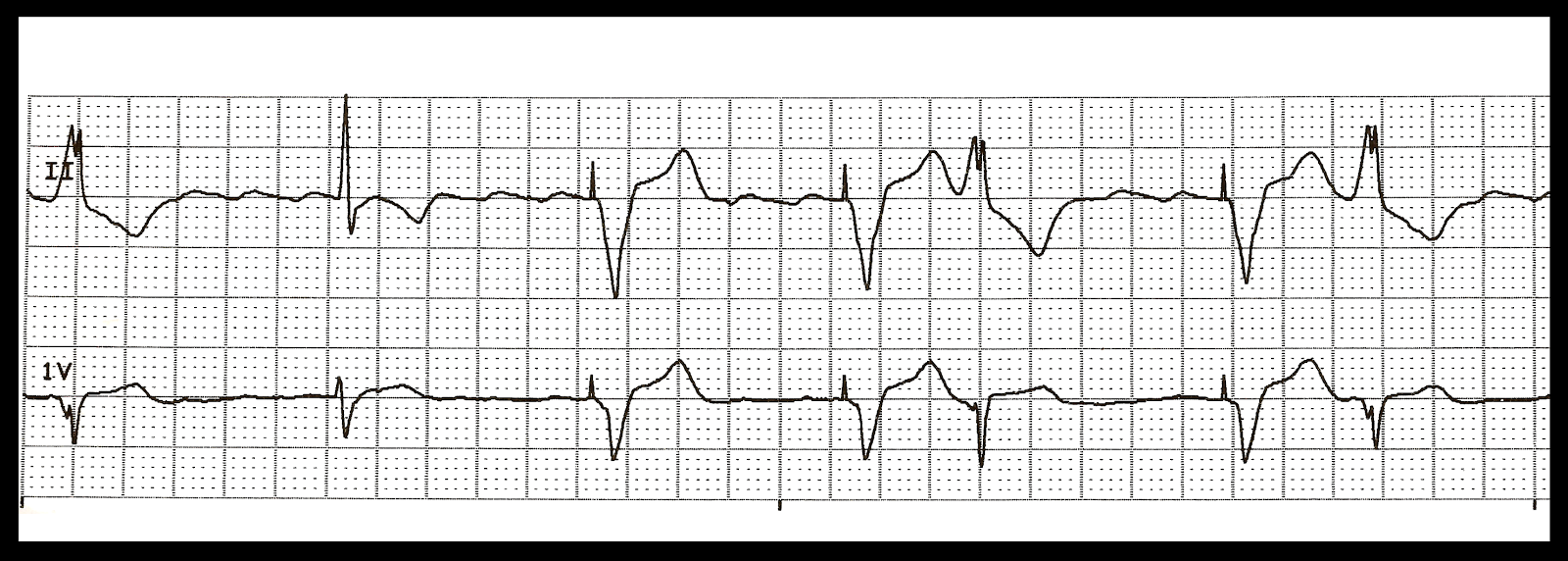 Practice Rhythm Strips 291
