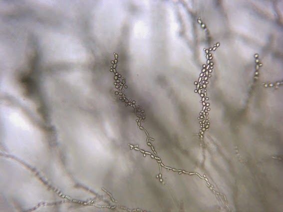 Fun With Microbiology (What's Buggin' You?): Trichosporon species