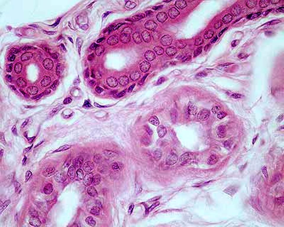 Plantão Médico: HISTOLOGÍA TEJIDO EPITELIAL DE REVESTIMIENTO Y GLANDULAR