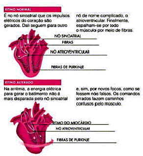 Healthy Sport: ALGUNS DISTÚRBIOS CARDÍACOS