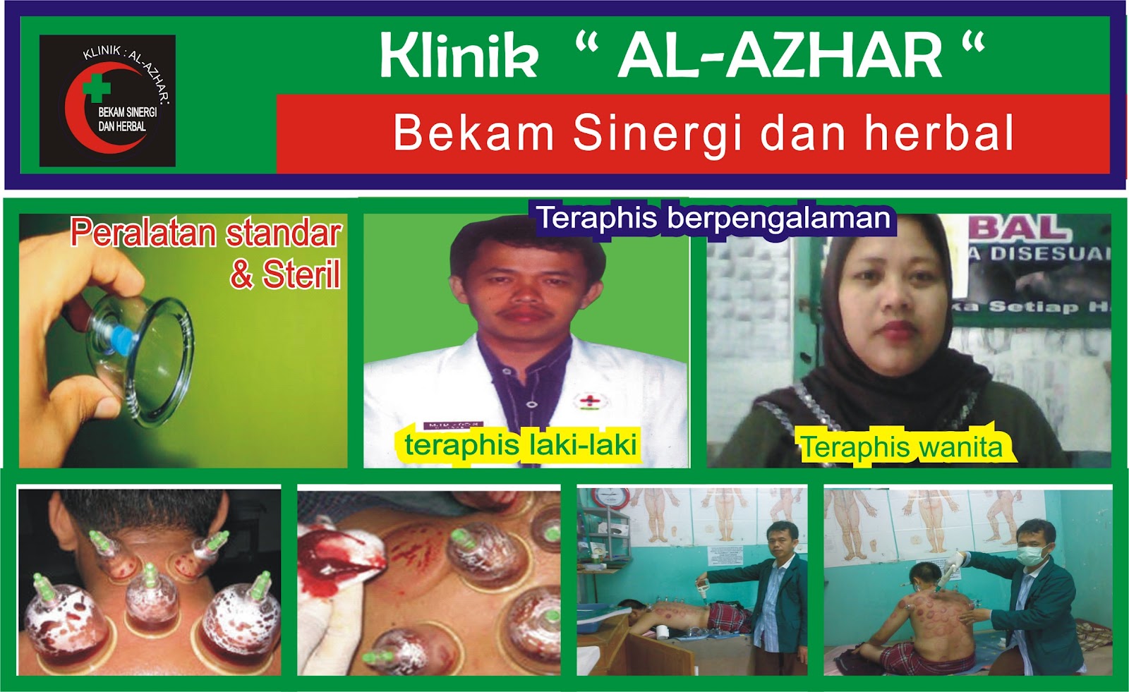 TERAPI BEKAM DI BOGOR IPB DRAMAGA Pengobatan Bekam, Akupuntur, Herbal ...