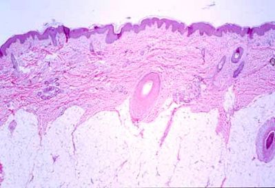 mcq on Histology of Integumentary System - Medsynapses