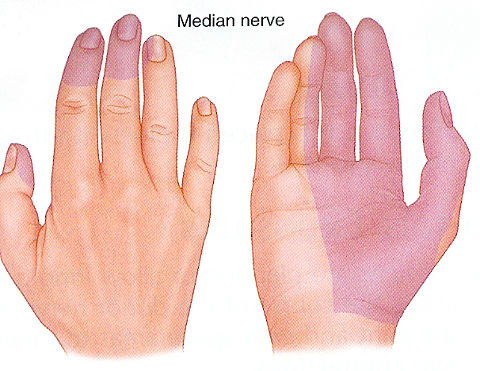 Physiotherapy Care: CTS