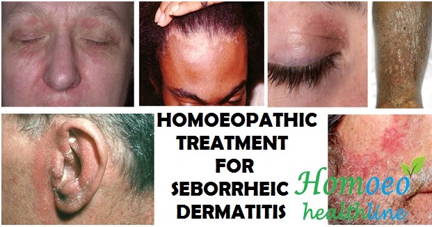 HOMOEO HEALTH ADVICE