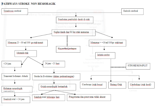 ASUHAN KEPERAWATAN STROKE NON HEMORAGIK: Askep Stroke Non Hemoragik(SNH)