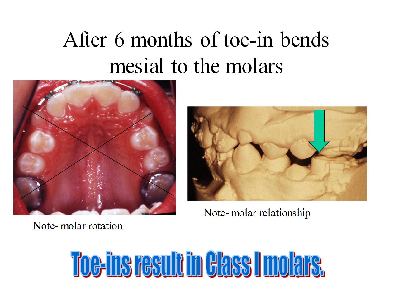 practical orthodontics: Diagnosis and treatment of mesially rotated ...