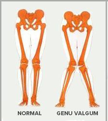 PERSONAL TRAINER H. UMMAN EMEKSİZ: POSTÜR (DURUŞ): POSTÜR NEDİR, DURUŞ ...