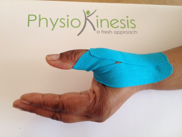 PhysioKinesisUK: "Gardener's Thumb" (overuse injury)