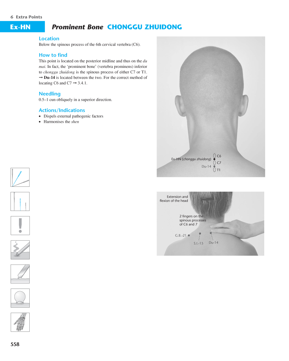 Acupuncture Masters: Acupuncture Points Database - Extra Points