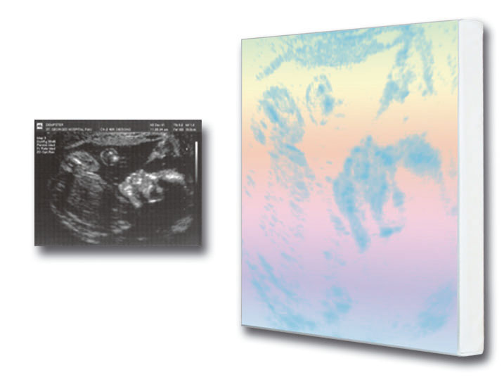 Baby Scan Artworks | deckflair