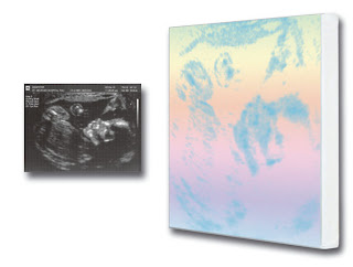 Baby Scan Artworks | deckflair