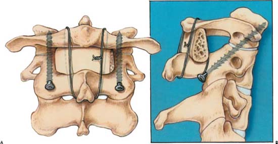 Ten Things That I Learned Today