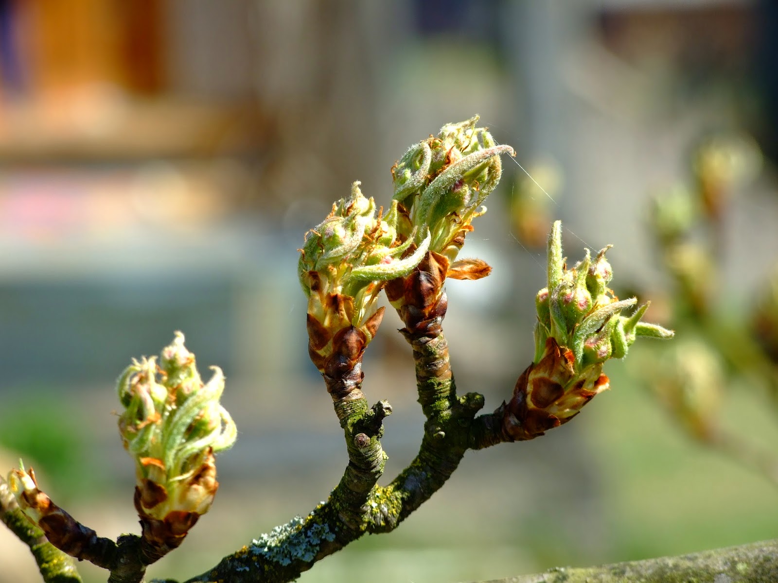 Chest Medicine Made Easy-Dr Deepu: The HRCT findings of Bronchiectasis.