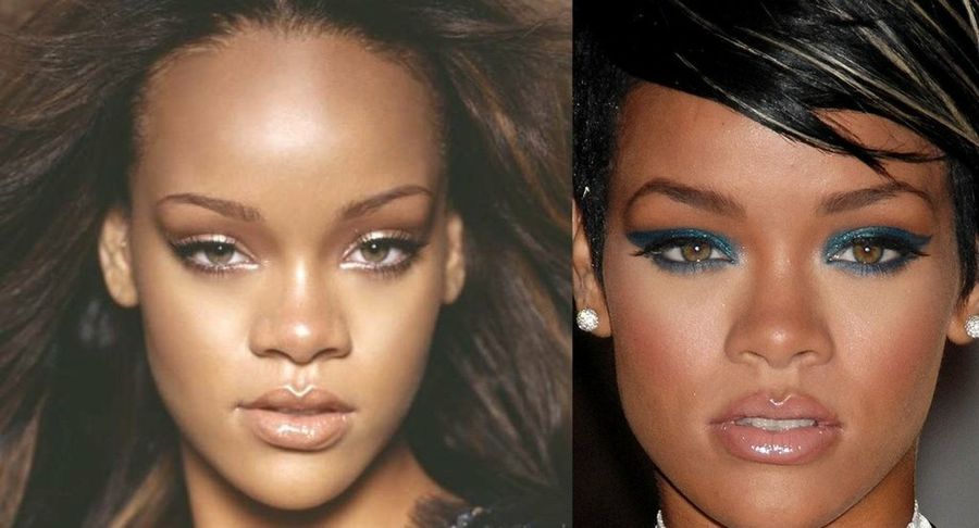 Las 10 Celebrities mejor operadas, descubre su antes y el después