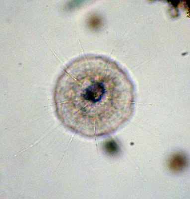 Beyond the Human Eye: Swallowed by the Sun Animacule