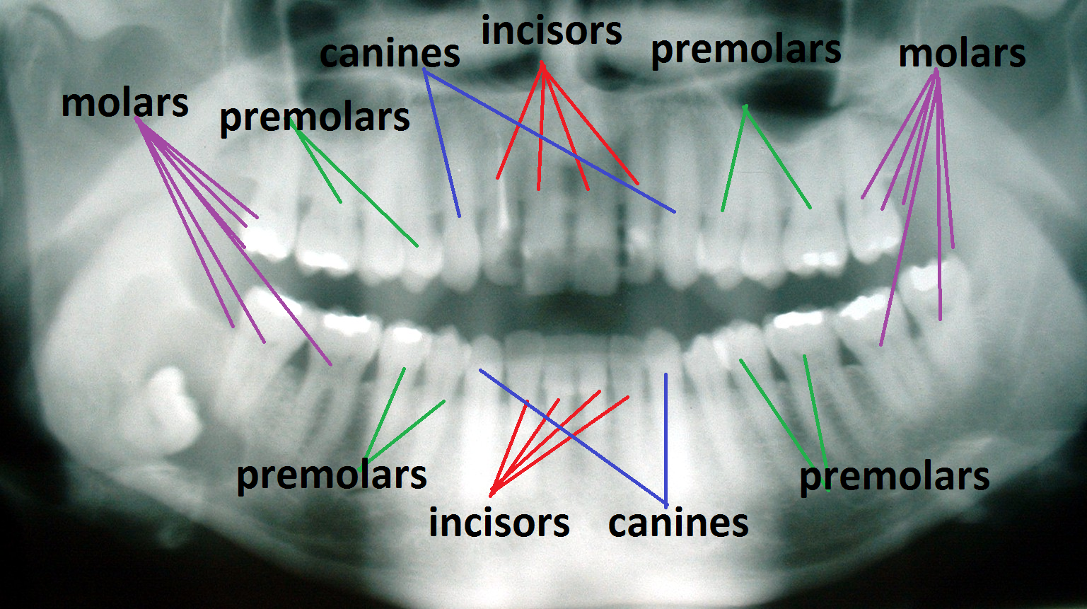 The Animal Bone Yard : Interesting teeth