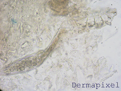 Dermapixel: junio 2012