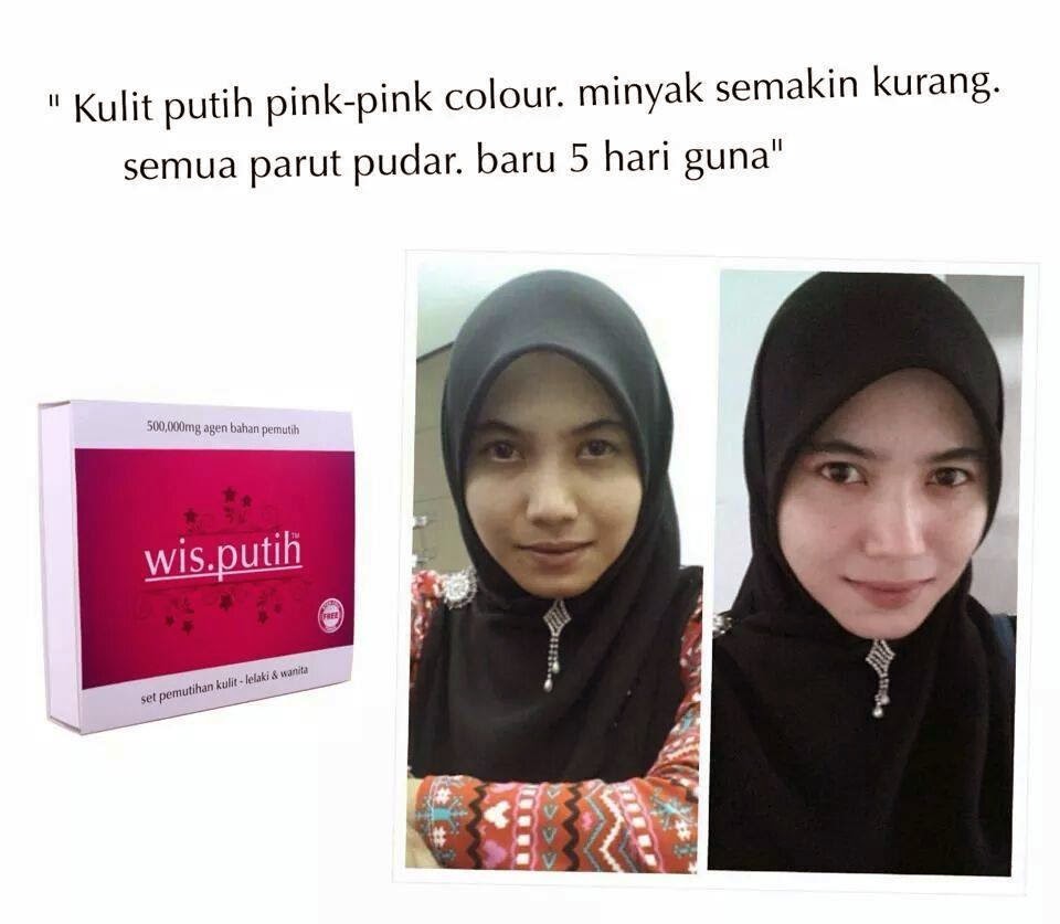 Produk Kecantikan & Kesihatan: WIS PUTIH SKINCARE FREE HYDROKINON