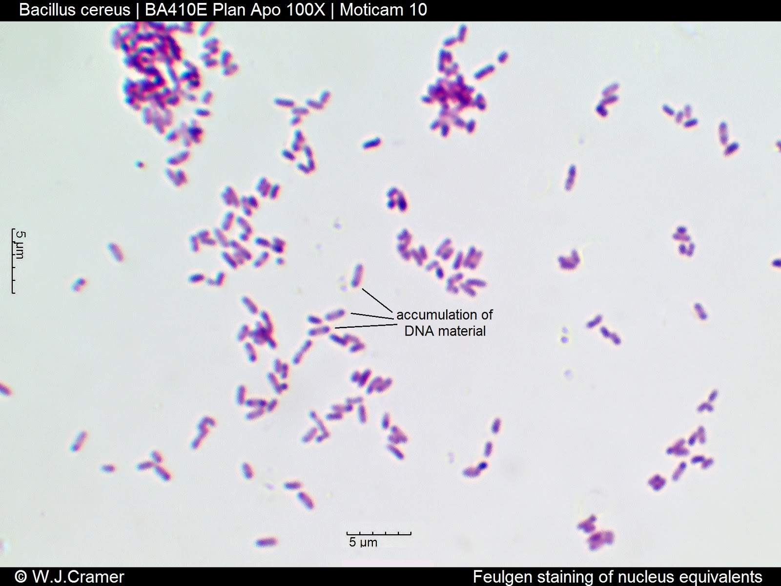Motic Europe | Blog: Feulgen stain, still indispensable for microscopic ...