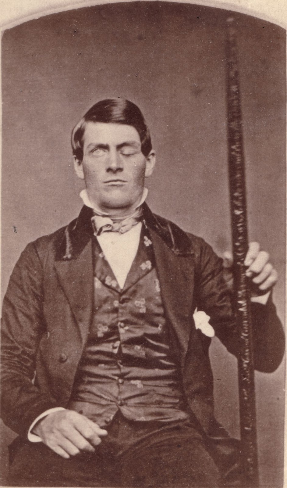 Uncovered After 150 Years: Here Are Two Known Portraits of Phineas Gage ...