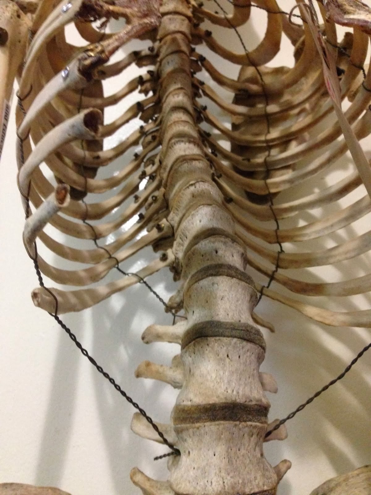 Antique Genuine Authentic Real Human Skull with Metopic Suture | REAL ...