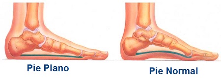 PIE PLANO
