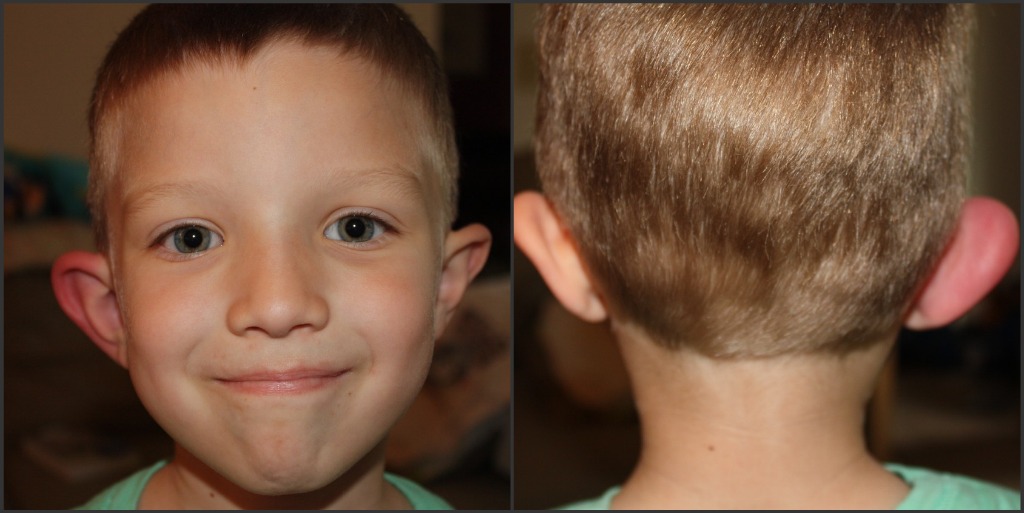 K3: Hot Days and Mosquito Bite Randomness