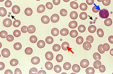 EL RINCÓN DE LA MEDICINA INTERNA. juanpedromacaluso@yahoo.com.ar ...