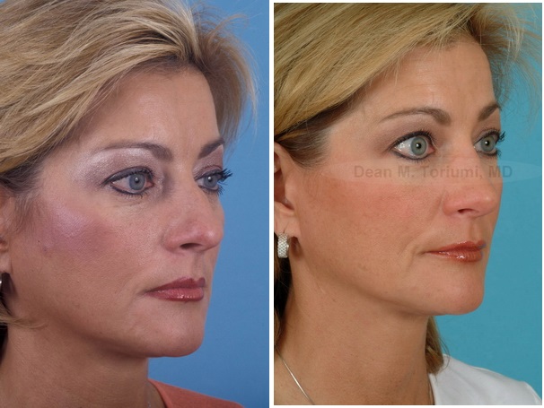 Dr. Dean Toriumi Reviews