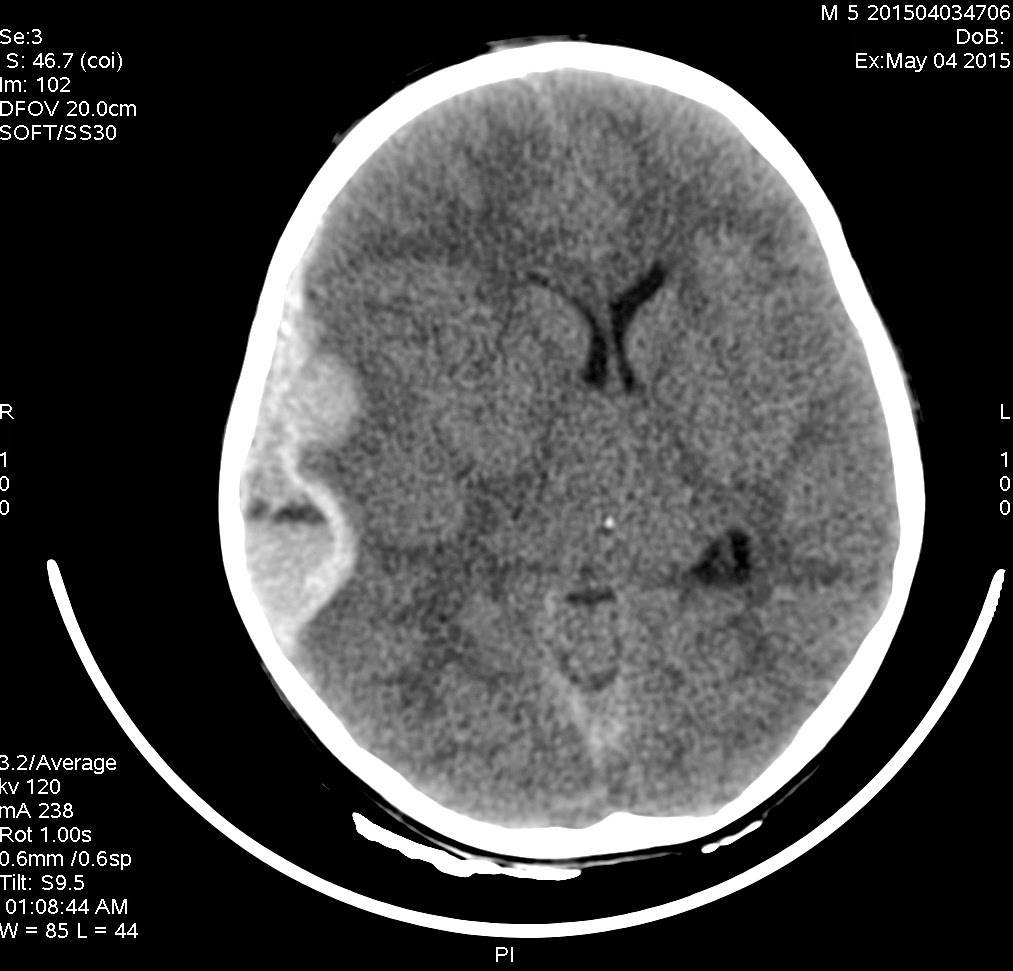 Varun's Radiology Blog