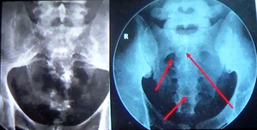 RADIOANATOMIA: CLASE 9