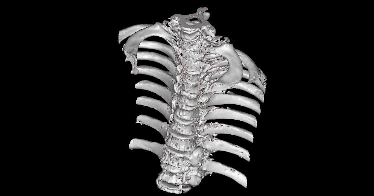 Anatomically Correct 3d Medical Reference Models 3d Thoracic Spine Model 3d Medical Model