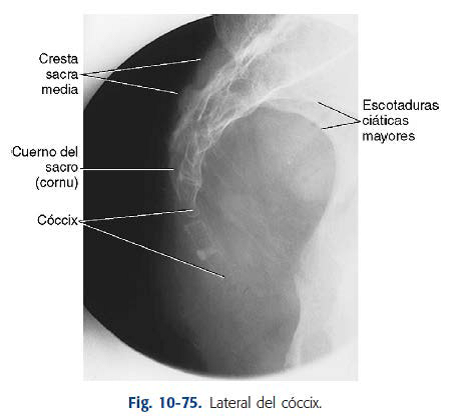 PRODUCCION Y TRATAMIENTO DE IMAGENES DIAGNOSTICAS: CAPITULO COLUMNA ...