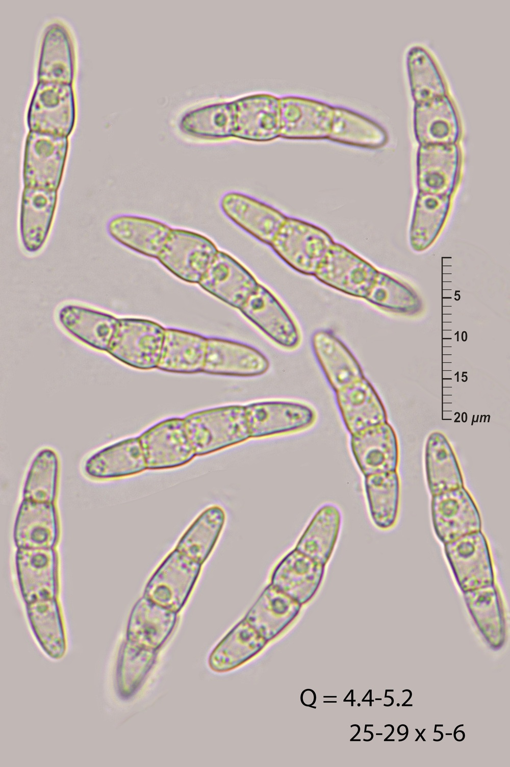 Phaeosphaeria eustoma (Auersw. ex Rehm) Leuchtm. • CEMAS