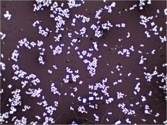 Negative Stains and Capsule Stains - Microbiology Laboratory Turkey