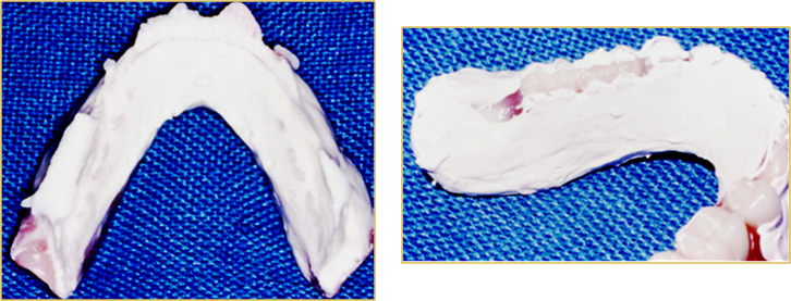 Dentistry and Medicine: Concept of Neutral Zone