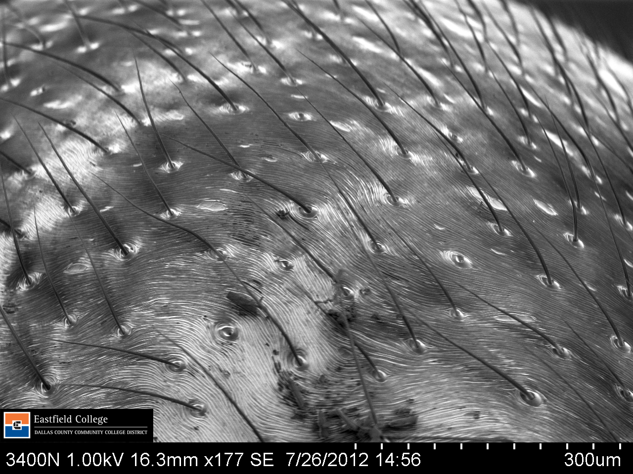 Scanning Electron Microscope Blog: A Flesh Eating Predator (Less than 3 ...