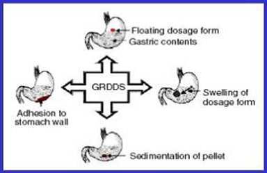 Pharma eXtremes: FLOATING DRUG DELIVERY SYSTEM
