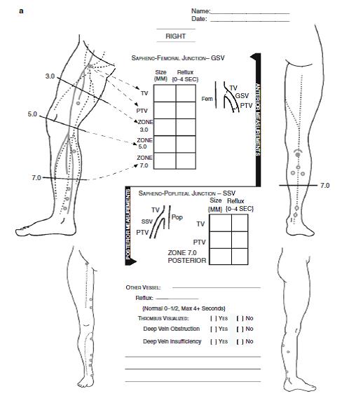Vascular Mind : DUPLEX WORKSHEET FOR CVI EXAMINATION