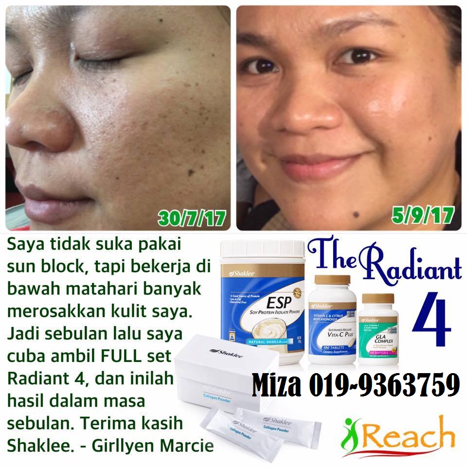 Cara Hilangkan Jeragat Cepat - 4 Langkah Mudah Terbukti Selamat ...