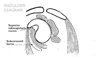 Subcoracoid-Subscapularis Bursa MRI - Sumer's Radiology Blog