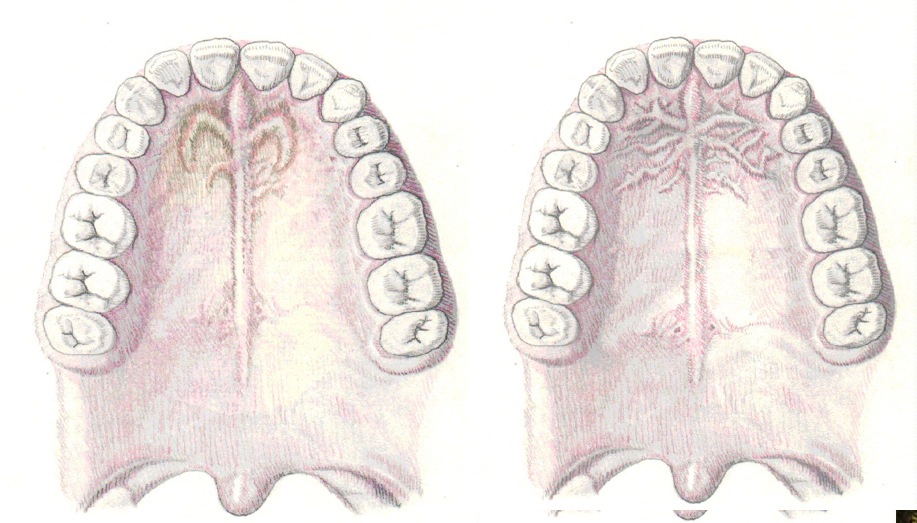 Adynata: El Palacio de la boca